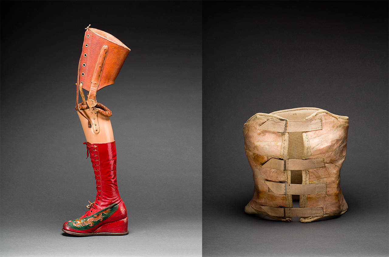 Prosthetic leg with leather boot (1953), Mexico. r- Plaster corset ...